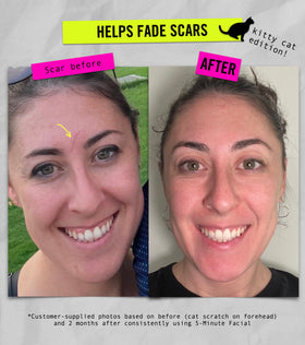 5-Minute Facial – Clean Your Dirty Face